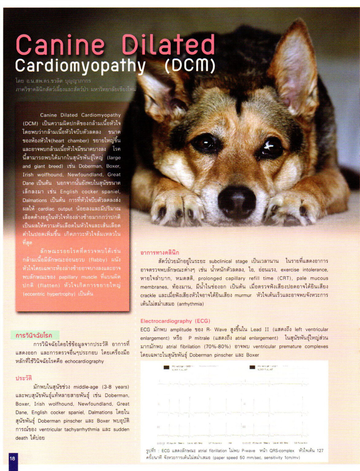 Canine Dilated Cardiomyopathy (DCM)